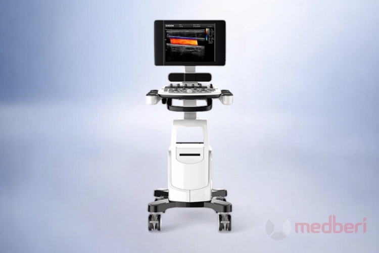 Chison Qbit 5: купить УЗИ аппарат Chison Qbit 5 new matrix по низкой ...