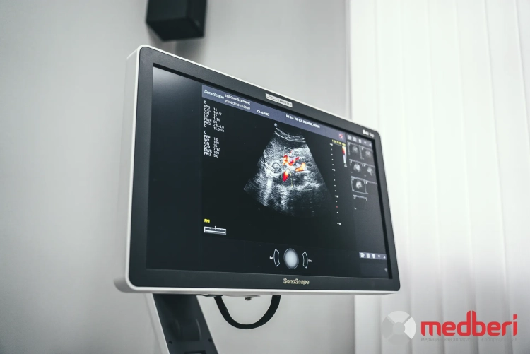 Купить УЗИ аппарат SonoScape S40Exp Vet по низкой цене - MedBeri